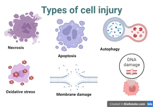 Cell injury- Introduction, Causes, Types, Mechanism, Morphology ...